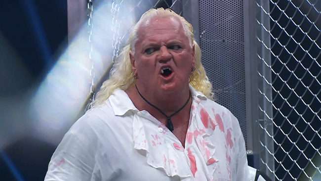 Gangrel underwent total hip replacement & total knee replacement surgery
