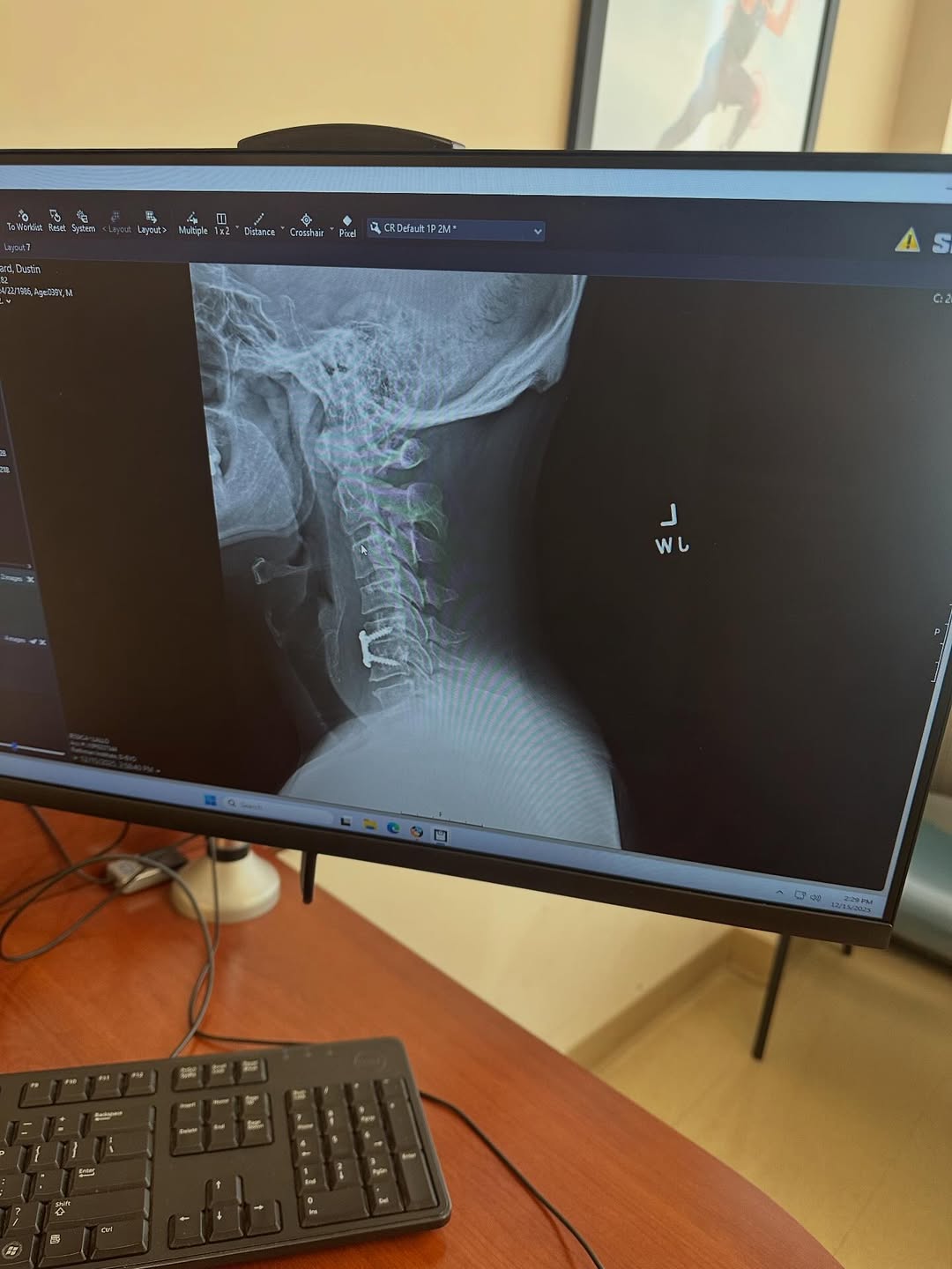 Chuck Taylor reveals he has undergone neck surgery